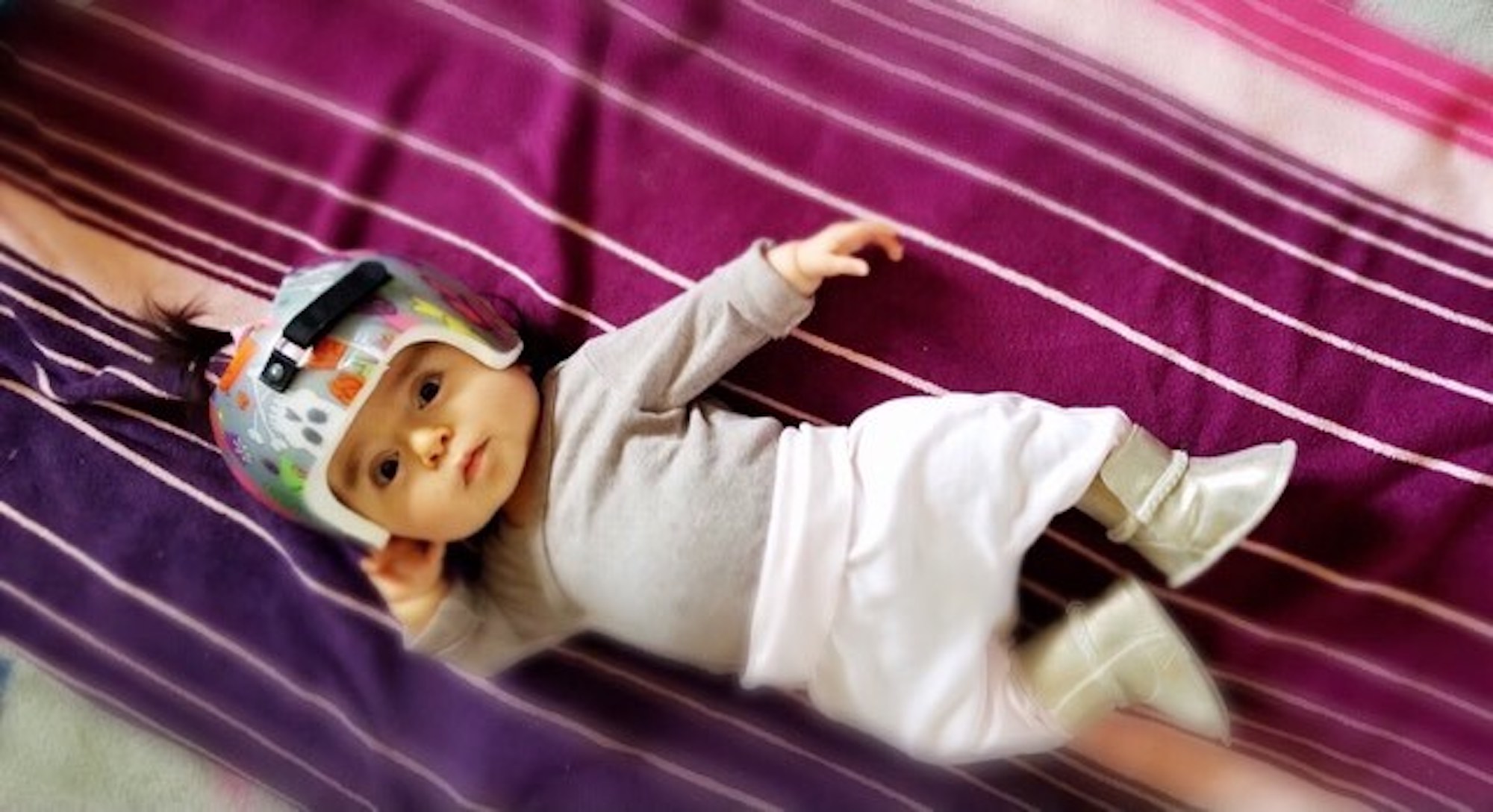 Baby Head Shape, Torticollis, and Chiropractic Care - Triada Health Ottawa